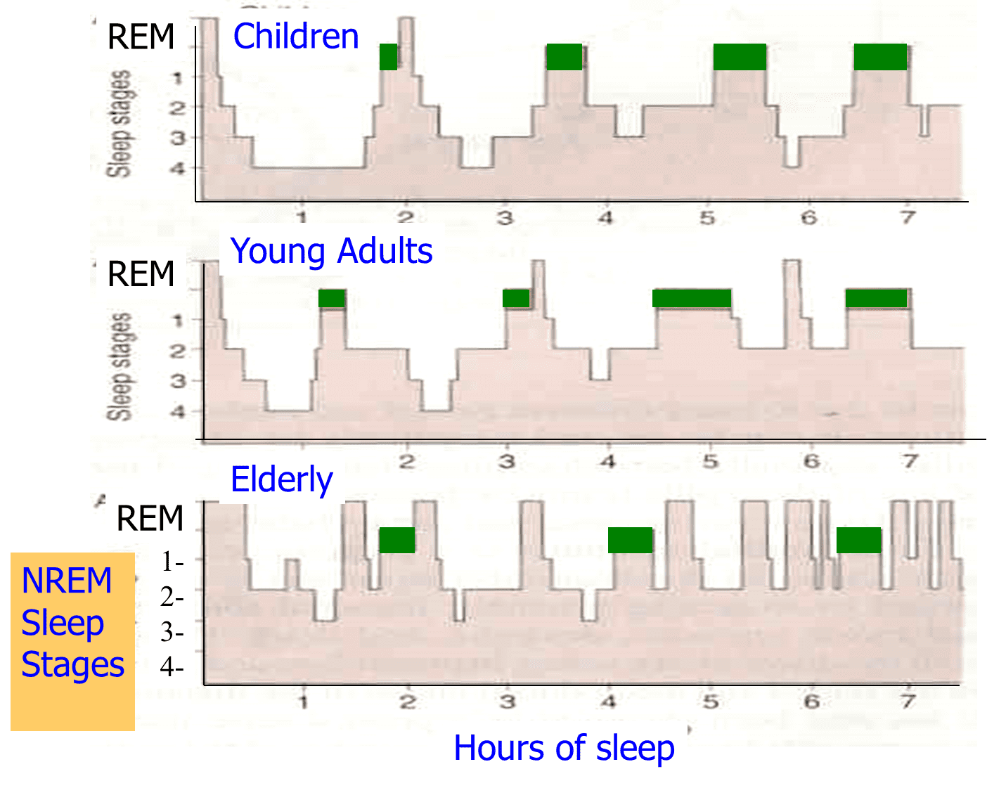 Physiology Of Sleep | Med School Hub