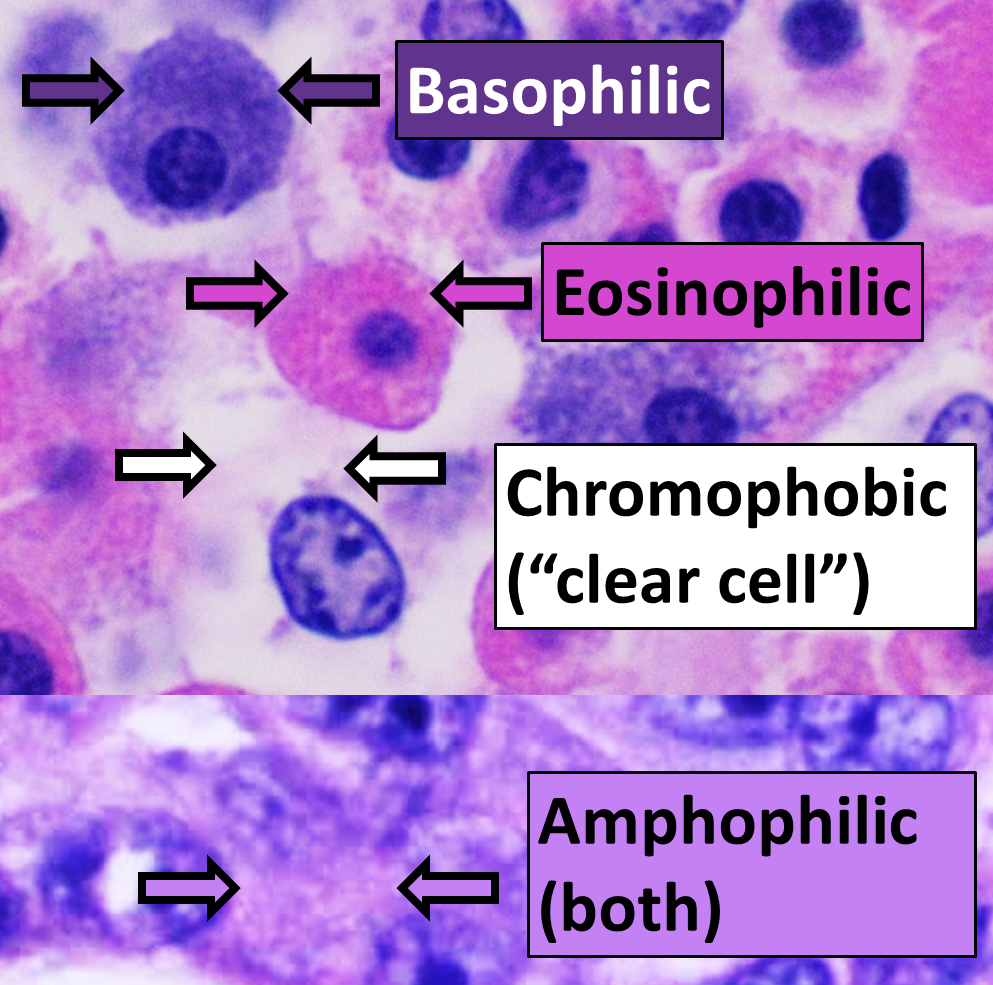 Eosinophilic vs Basophilic: How to tell the difference | Med School Hub